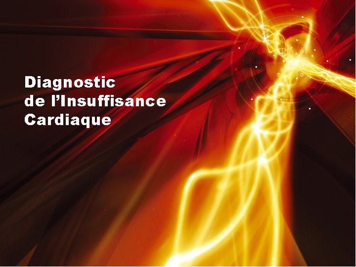 Insuffisance cardiaque L 2 INSUFFISANCE CARDIAQUE Une pathologie