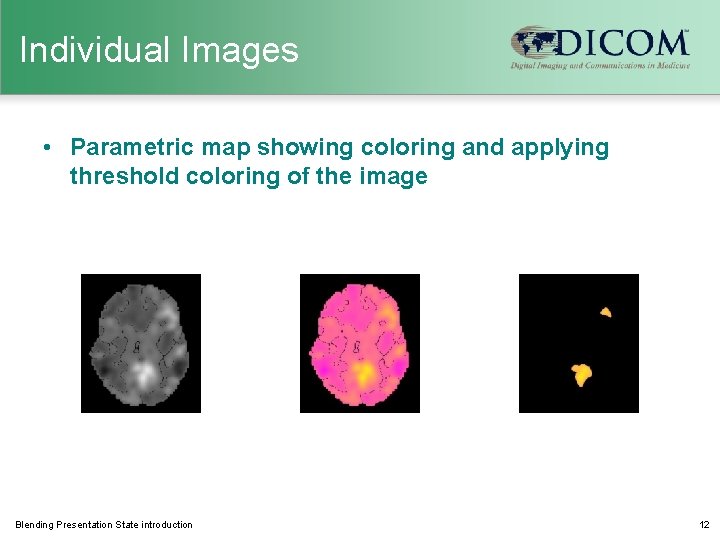 Supplement 189 Parametric Blending Presentation State Storage 1