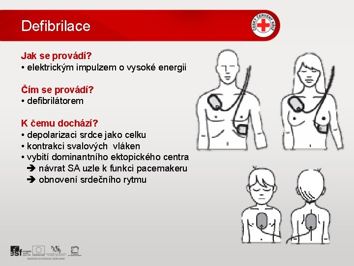 Automatizovan extern defibriltor Anatomie srdce horn a doln