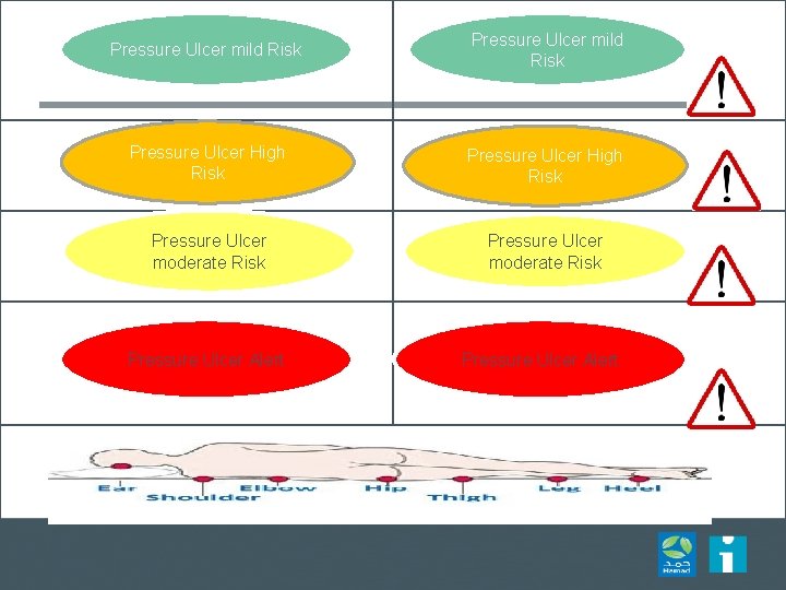 Device related pressure Ulcer in Cardio thoracic intensive