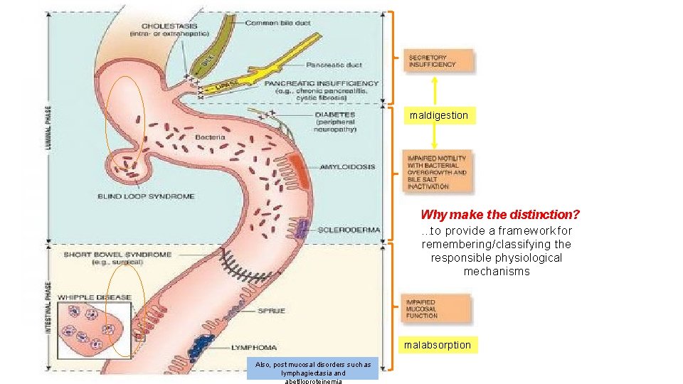 Chronic Diarrhea Suliman Alshankiti Objectives To have an