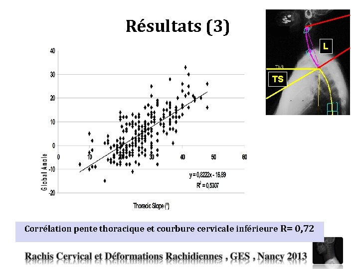 Etude morphologique de la courbure cervicale infrieure dans