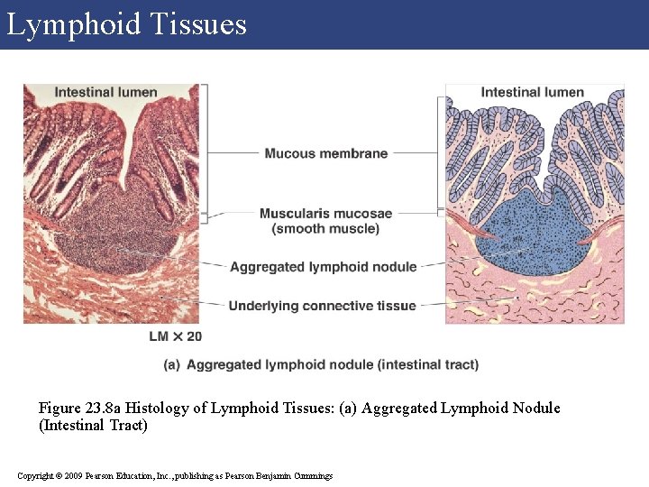 Chapter 23 The Lymphoid System Power Point Lecture