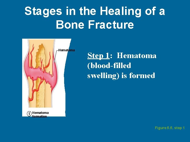 SKELETAL SYSTEM Functions of Bones Support hard framework