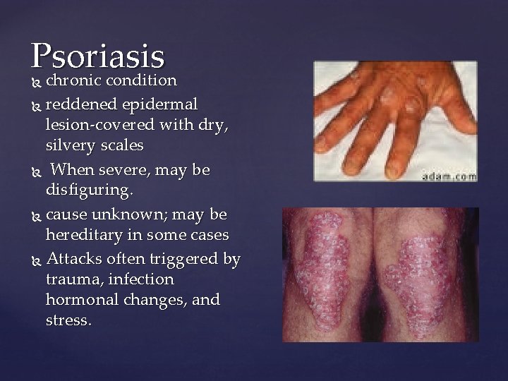 Infections and Allergies Of Skin The most common
