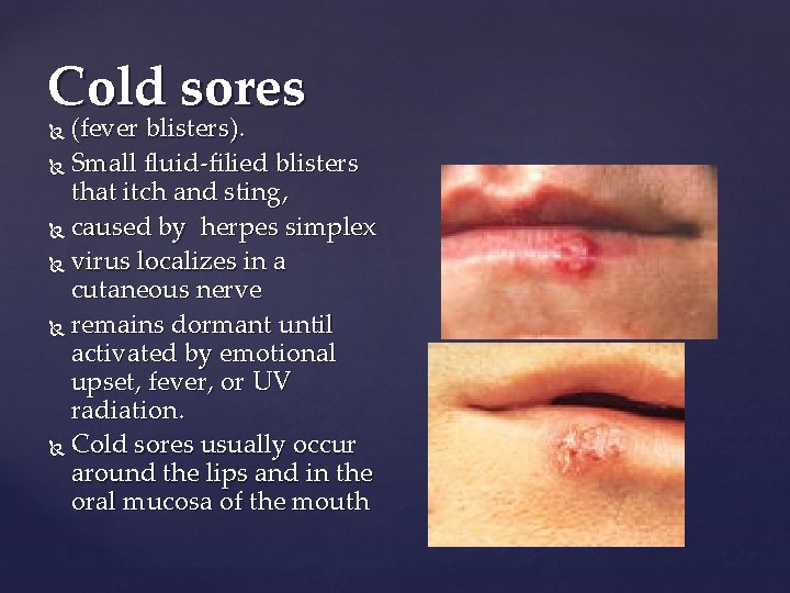 Infections and Allergies Of Skin The most common