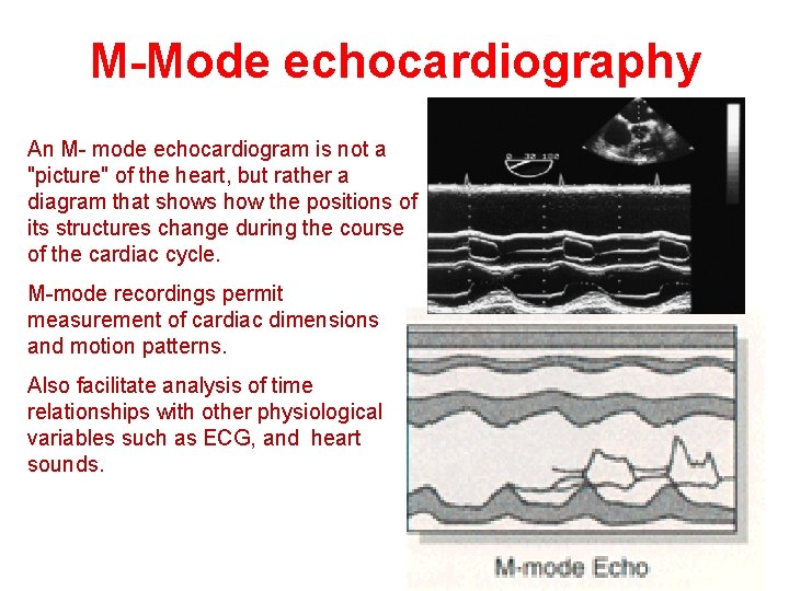 5 Basic Principles of Echocardiography Rasoul Azarfarin MD