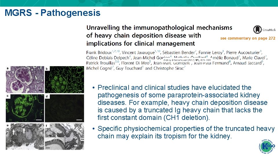 MANAGEMENT AND TREATMENT OF GLOMERULAR DISEASES MEMBRANOPROLIFERATIVE ...