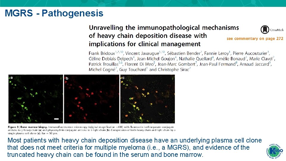 MANAGEMENT AND TREATMENT OF GLOMERULAR DISEASES MEMBRANOPROLIFERATIVE ...
