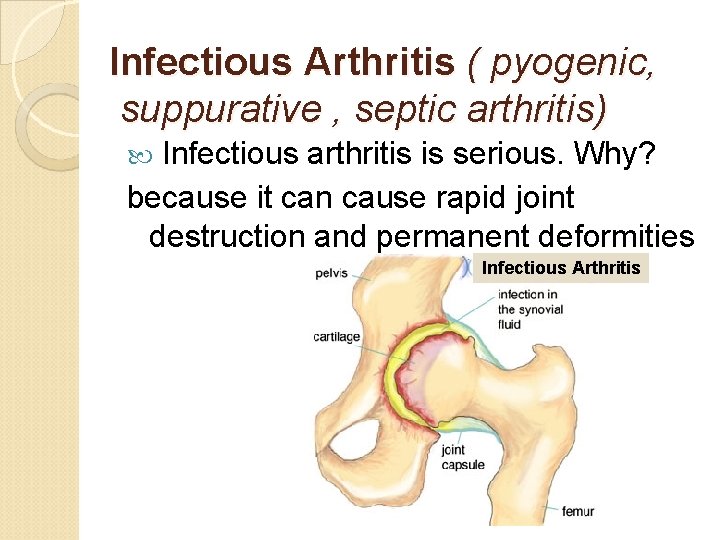 MUSCULOSKELETAL BLOCK Pathology OSTEOMYELITIS and SEPTIC ARTHRITIS Dr