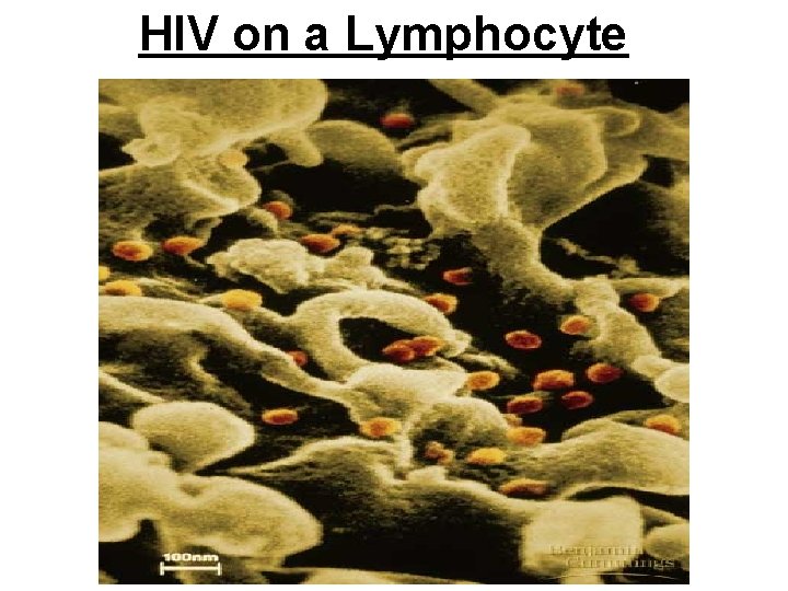 Immune System immunus to be free primary defense