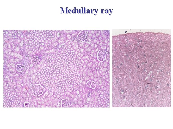 Morphology and histology of kidney Dr Zita Puskr