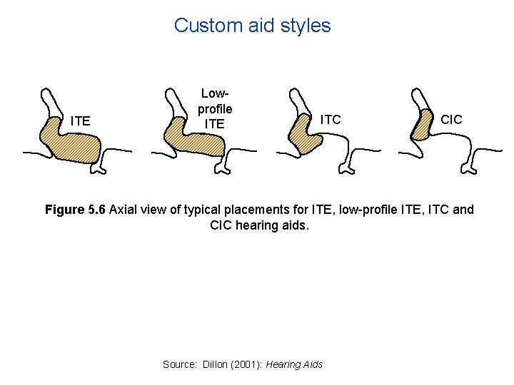 Figures for Chapter 5 Earmolds and earshells Dillon