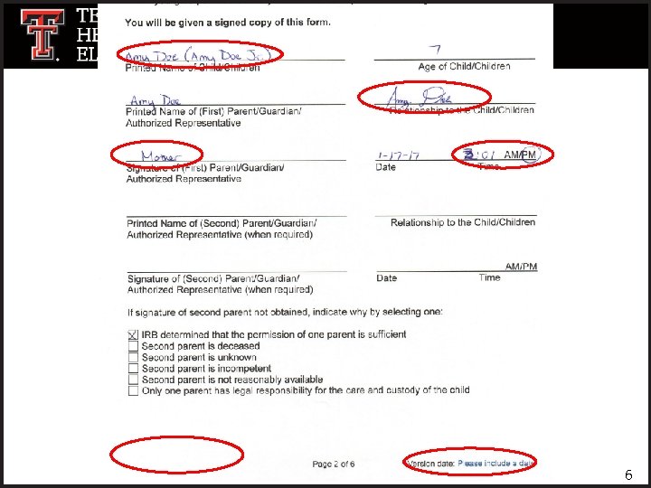 Typical Informed Consent Mistakes and How to Address