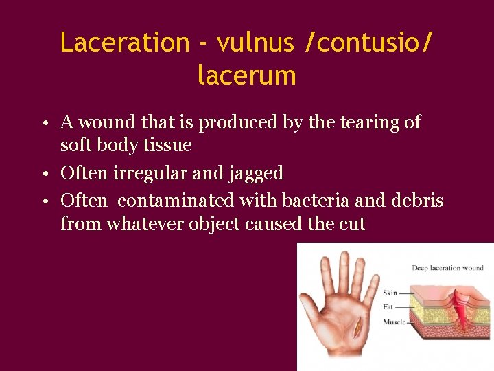 FN Brno October 2010 Summary Types of wounds