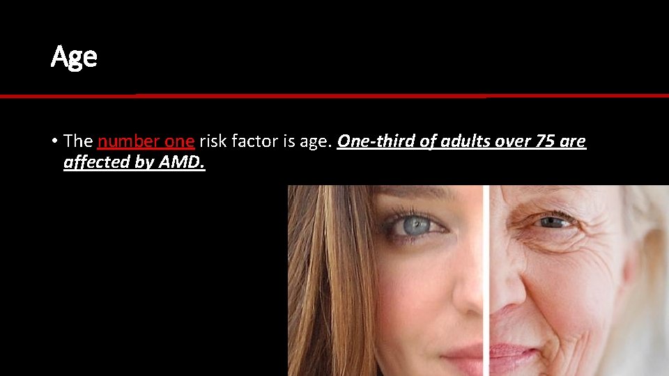 AMD Genetic Risk Factors A Khodabande Farabi Eye