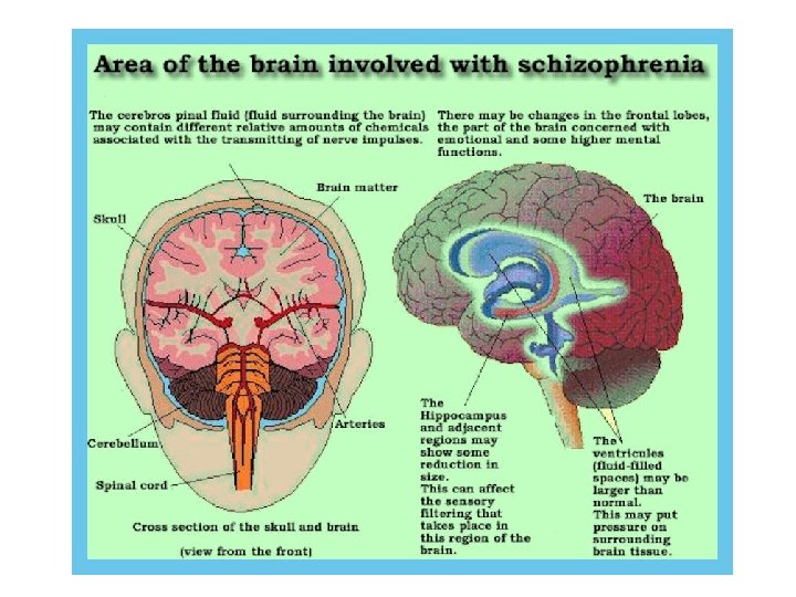 Schizophrenia Pages 201 204 of Year 2 book