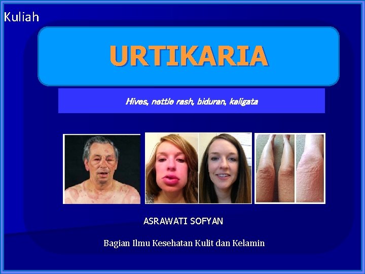 Kuliah URTIKARIA Hives nettle rash biduran kaligata ASRAWATI