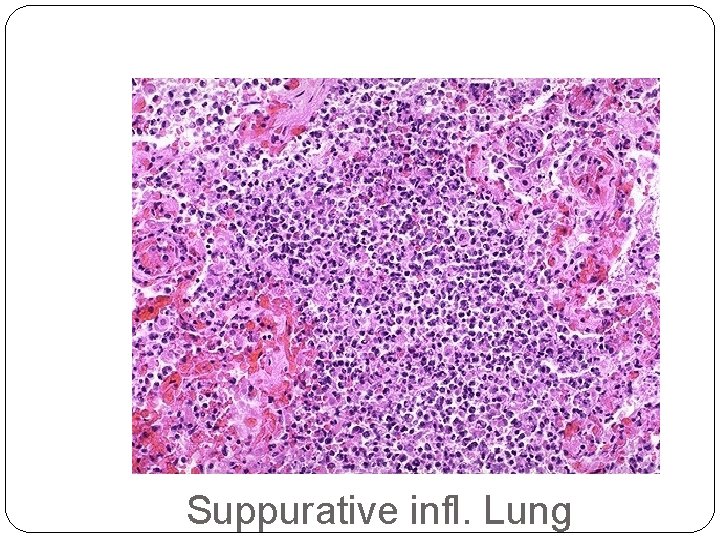 Pathology of infectious diseases lab Types patterns of