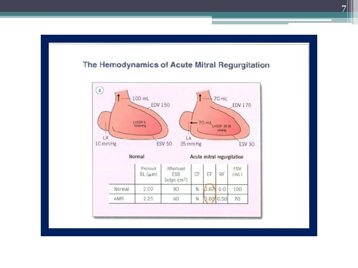 1 Assessment of Mitral Aortic Regurgitation At Bed