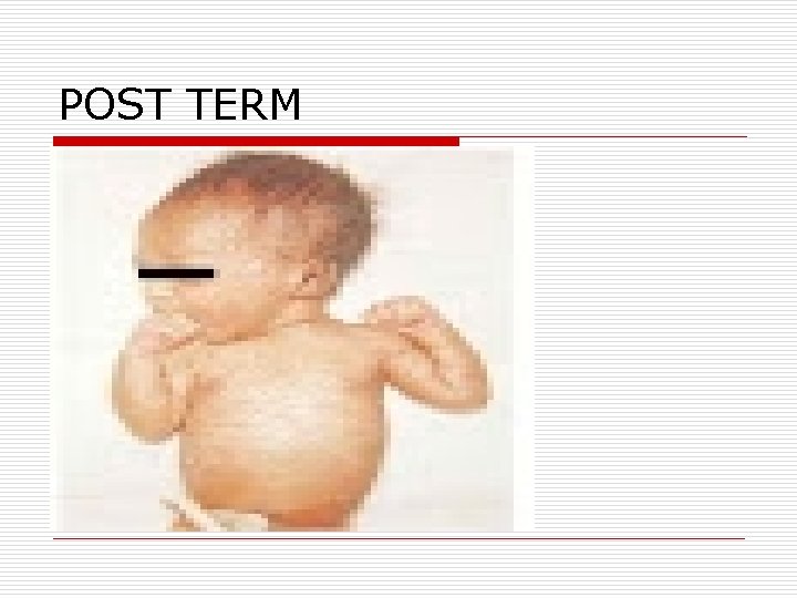 Nursing Care of newborn Objectives o Discuss priorities