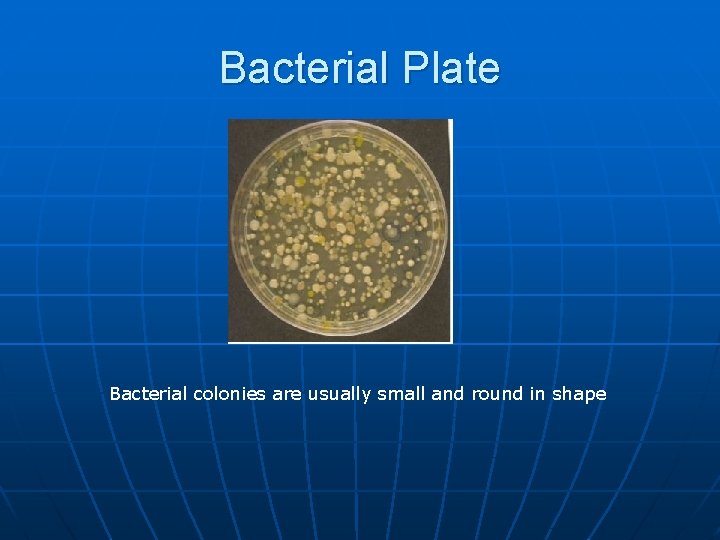Microbiology is the study of microorganisms which are