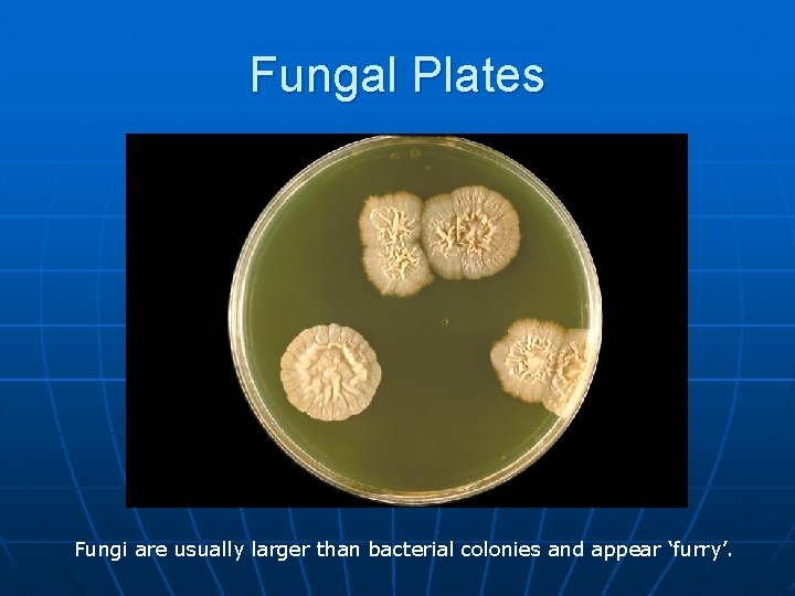 Microbiology is the study of microorganisms which are