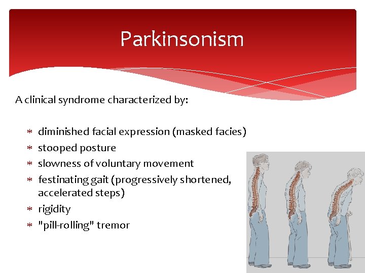 Introduction to Degenerative Brain Diseases Objectives Explain the