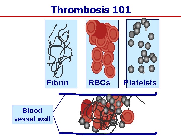 Venous Thromboembolism By G Sadasiva Rao M Pharm
