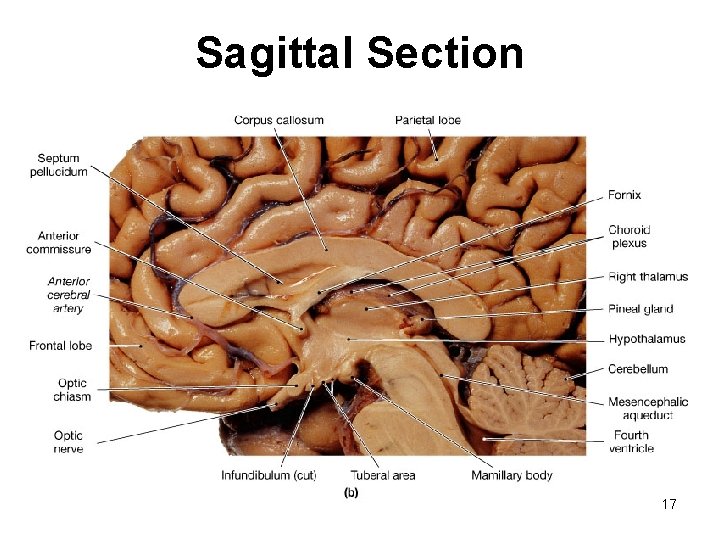 Anatomy of the Brain and Cranial Nerves 1