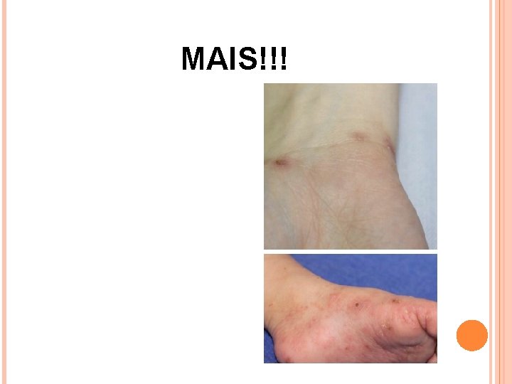 DERMATOPEDIATRIE JEUDI 12 MARS 2015 BOULOGNESURMER CLINE BCOURT