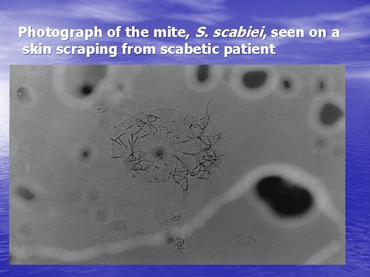 PARSITIC SKIN DISEASES BY Dr Nagat Sobhy Prof