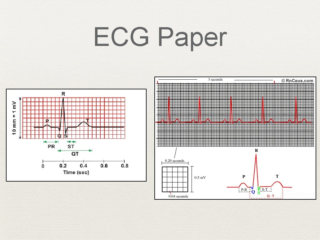 Electrical Activity of the Heart Topic Number 2