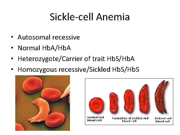 Natural Selection Uncovering Evolutionary Correlations between Sickle Cell
