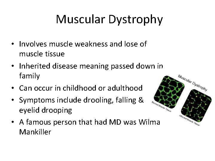 Diseases That Affect The Muscular System By Bhargavi