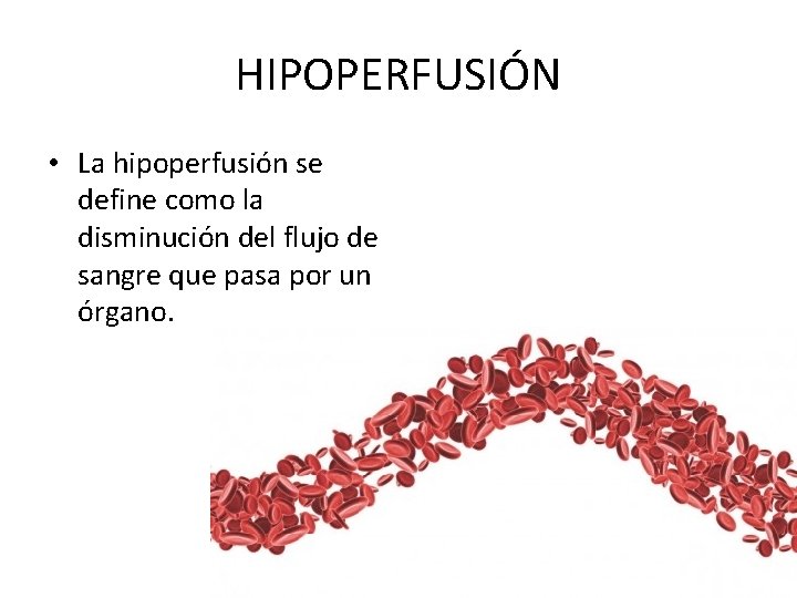 Glosario IBC Camila Garca Rodrguez Gpo 1105 HIPOPERFUSIN