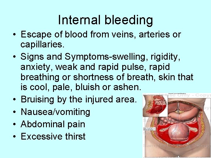 Chapter 10 Bleeding Bloodaverage blood volume in an