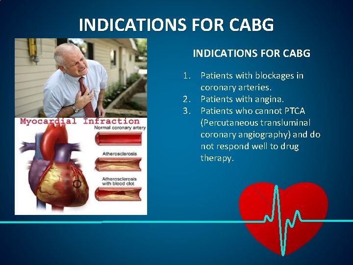 CORONARY ARTERY BYPASS GRAFT SUBMITTED BY Miss A
