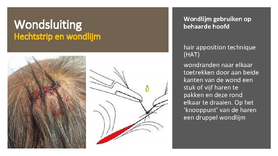 Behandelen Wondsluiting 10 11 2020 Boek MTH DA
