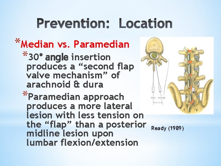 Post Dural Puncture Headache Prevention Assessment and Treatment