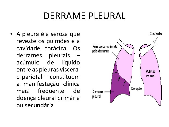 RX DE TRAX PNEUMOPATIAS ATELECTASIAS A atelectasia uma