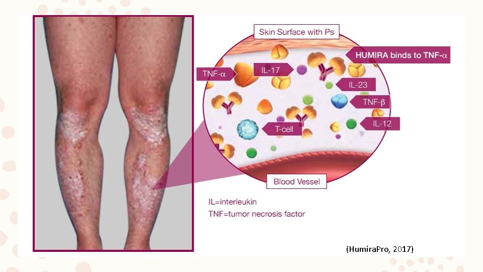 Treating Psoriasis A Guide to Understanding Biologics Marlee