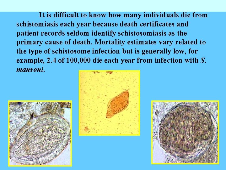 Schistosomiasis bilharziasis Schistosomiasis infectious diseases caused ...