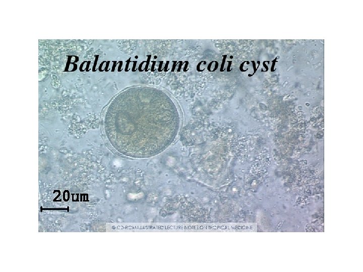 Intestinal Protozoa Balantidium coli Balantidium coli Is a