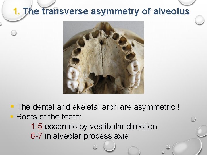MAXILLA Upper jaw Anatomy Clinical notes Dentoalveolar topography