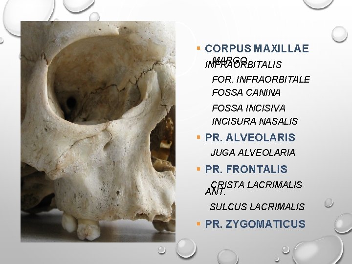 MAXILLA Upper jaw Anatomy Clinical notes Dentoalveolar topography