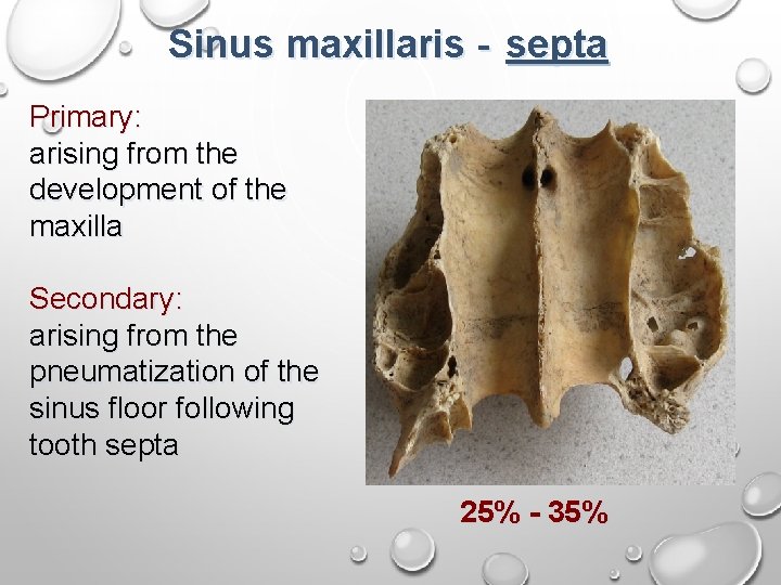MAXILLA Upper jaw Anatomy Clinical notes Dentoalveolar topography