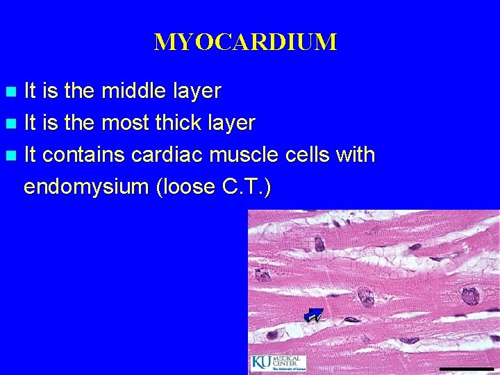 WALL OF THE HEART AND CARDIAC VALVES By