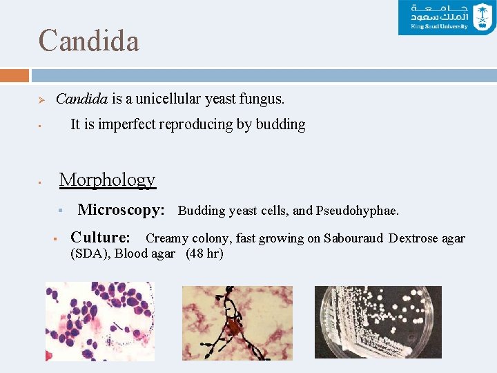 CANDIDIASIS Objectives Students at the end of the