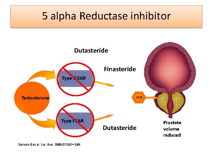 Component of BOO A dynamic physiologic reversible component